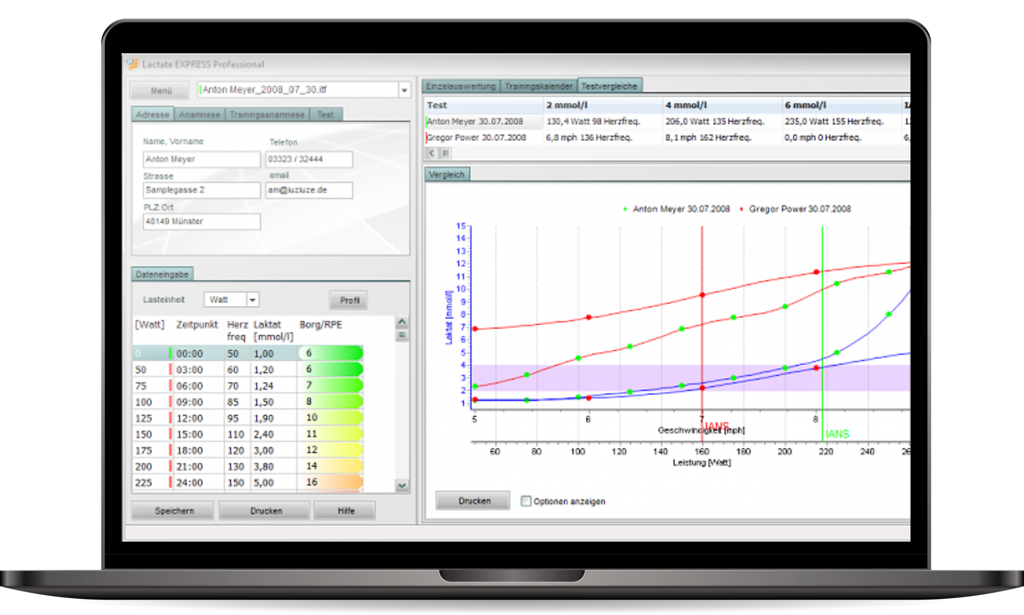 Lactate Express – mesics GmbH
